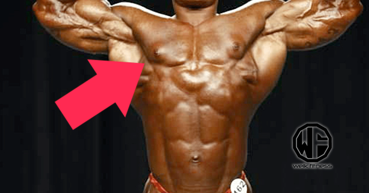 Bodybuilding Gynecomastia: What Are the Causes & Treatment?
